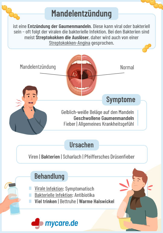 Ratgeber Mandelentz ndung Symptome Und Ursachen Einer Tonsillitis Ratgeber Mandelentz ndung Symptome Und Ursachen Einer Tonsillitis